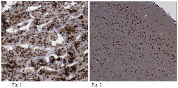 Anti-MNX1 (HB9) Antibody | ABN174